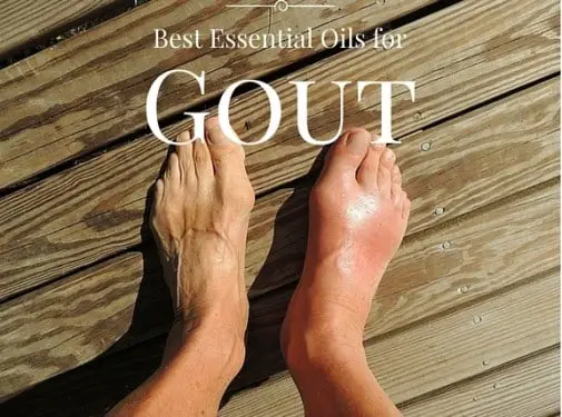 Best Essential Oils for Gout (A Natural Solution That Works!) - For ...